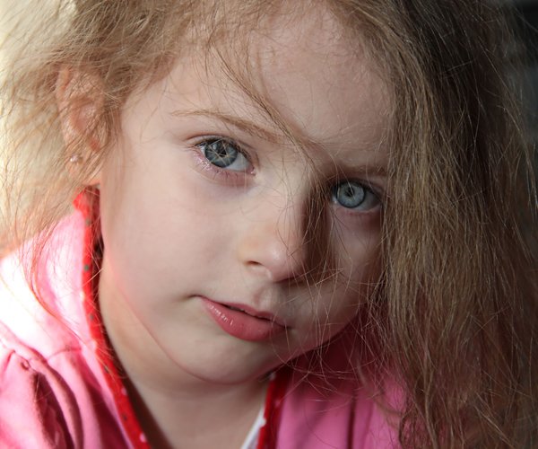 Rapunzel Syndrom: Wenn das Kleinkind Haare isst