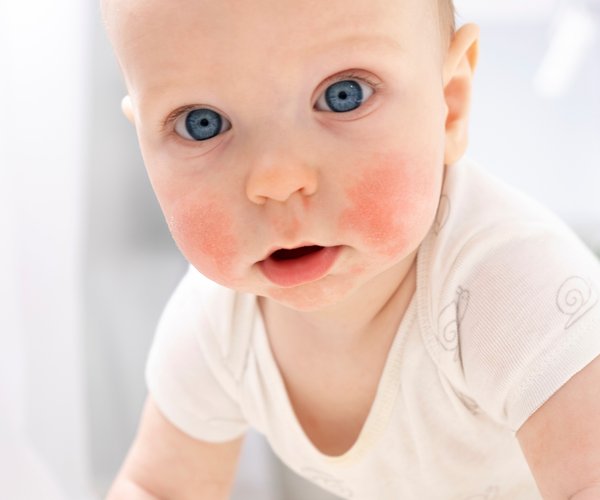 Durchfall beim Baby: Ab wann ihr zum Arzt müsst