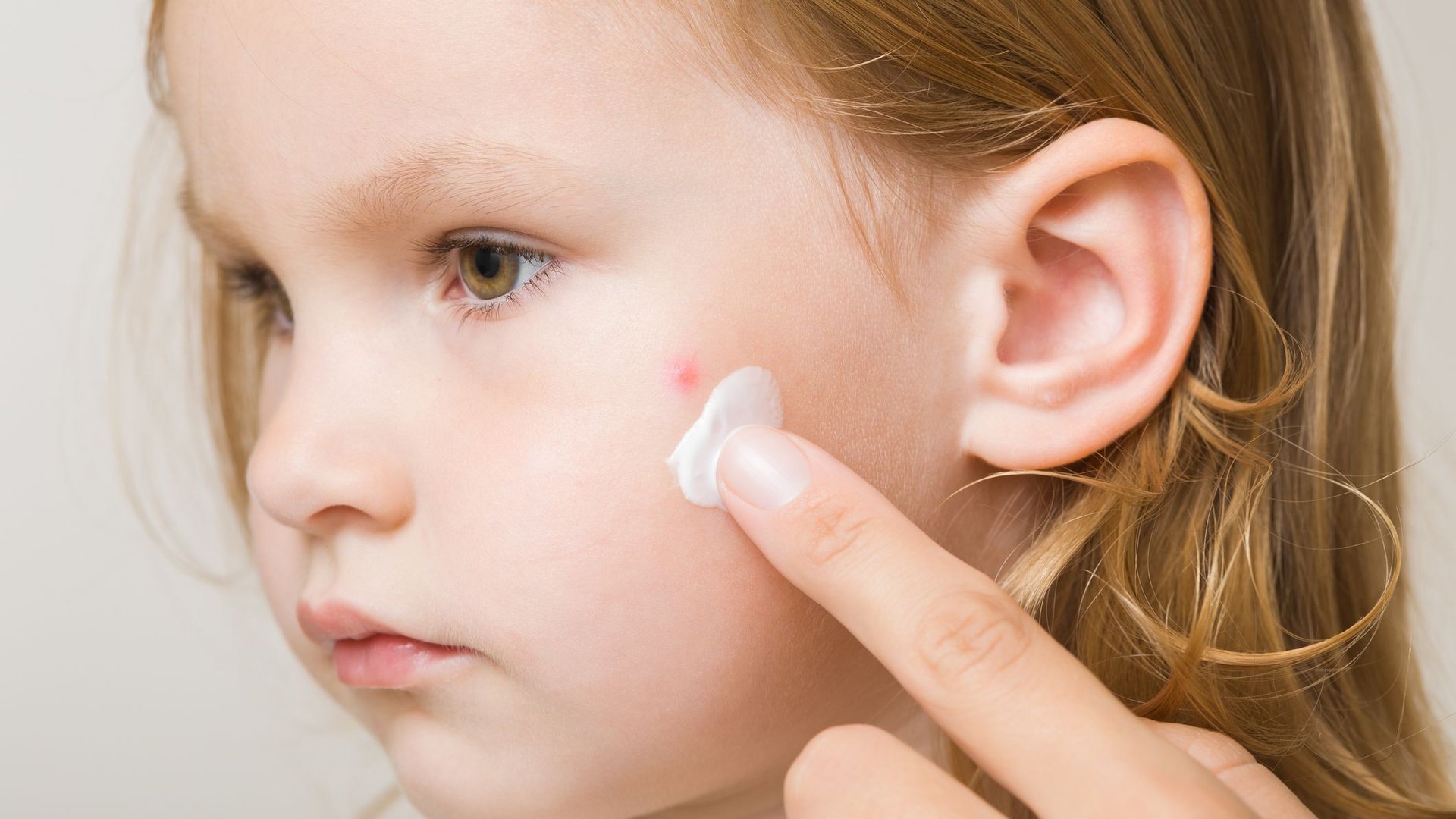 Symptome des Furunkels und was deinem Kind hilft