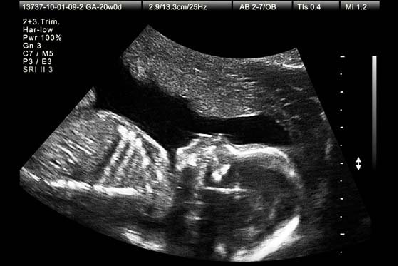 Vom Pünktchen zum Däumchenlutscher: Was du ab welcher SSW im ...